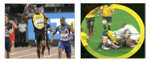 Hamstring Muscle Injuries – IONA Physiotherapy | Physiotherapy in Dublin